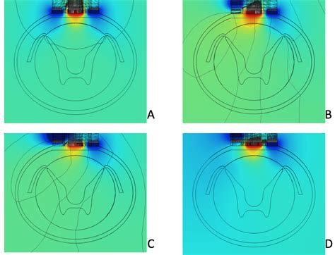 Just Published Paper On Modeling Spinal Column Stimulation Comsol Blog