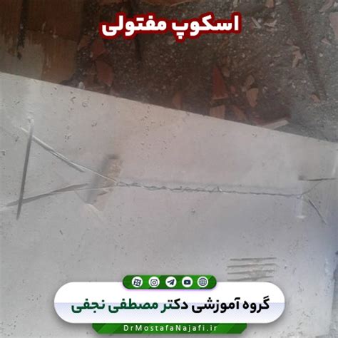 اسکوپ سنگ چیست؟ بررسی تصویری و روش‌های مختلف اسکوپ‌گذاری نما دکتر مصطفی نجفی مقالات