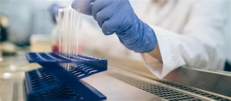 Soil Testing Types Sampling Interpretation Of Results