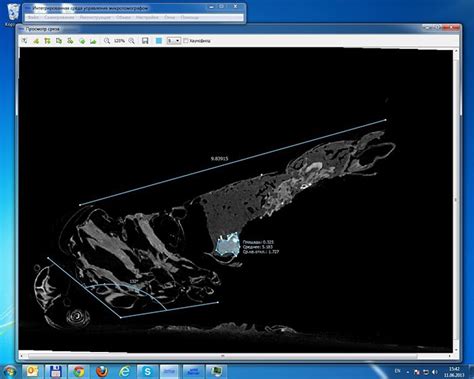 Coding 3d Rendering Software For New Tomography Device In C And Qt