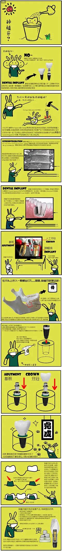 种植牙图片大全 种植牙高清好看的图片 花瓣未过已散的画板