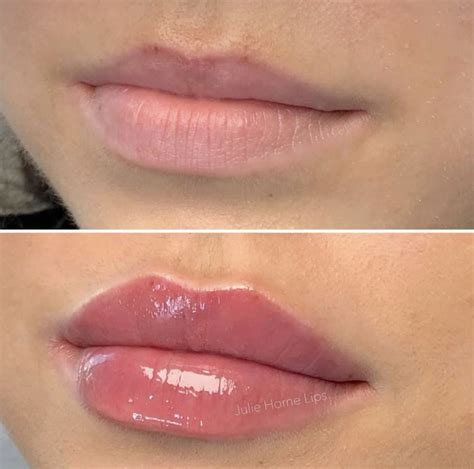 This Lip Filler Is Perfect 😍 Follow Me For More Daily Beauty Inspo