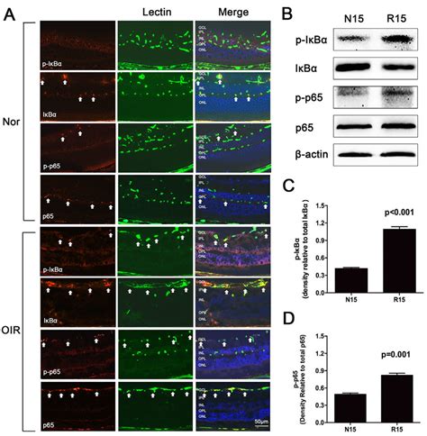 The Expression Of P Iκbα Ικbα P P65 And P65 Was Examined By