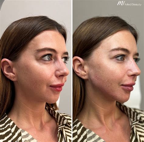 M1 Med Beauty Austria Ihre Nummer 1 für Schönheitsmedizin