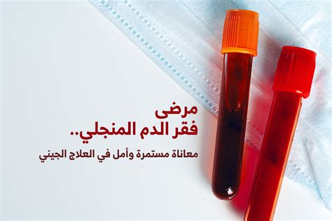 مرضى فقر الدم المنجلي معاناة مستمرة وأمل في العلاج الجيني جهات