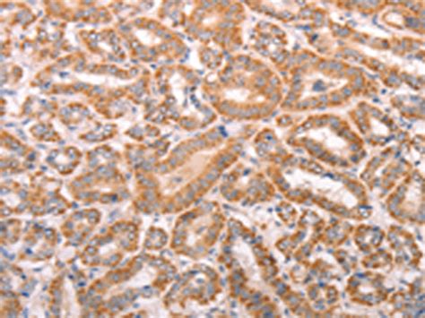 兔抗trpv4多克隆抗体anti Trpv4 Rabbit Polyclonal Antibody 生命科学产品与技术服务 生工生物工程