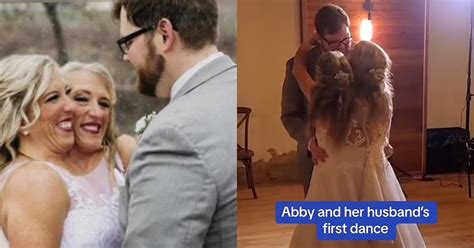 Conjoined Twin Abby Hensel Is Married • Philstar Life