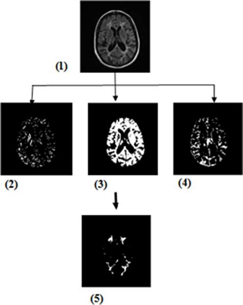 1 Original Brain Image 2 3 4 Segmentation Results By Ais Brain