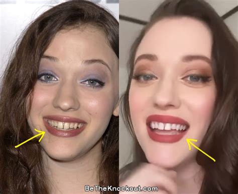 Kat Dennings Teeth