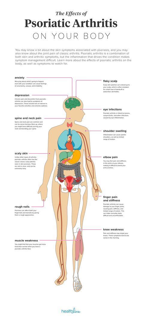 How Psoriatic Arthritis Affects The Body Artofit
