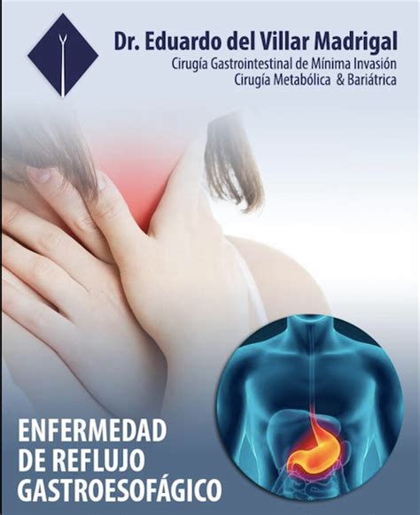 La Enfermedad De Reflujo Gastroesofágico Aparece Cuando El Contenido
