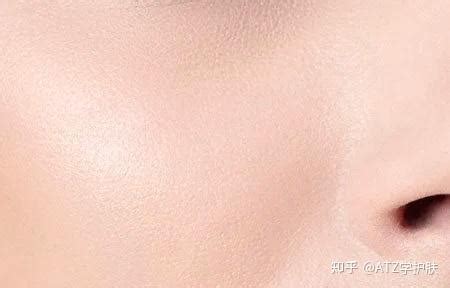 了解皮肤类型和状况 知乎