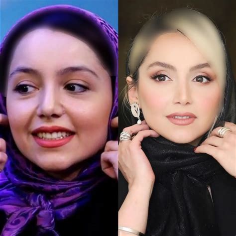 عکس نازنین بیاتی قبل از جراحی های زیبایی تغییر چهره جذاب خانم بازیگر بعد از استایل های سوپرلاکچری