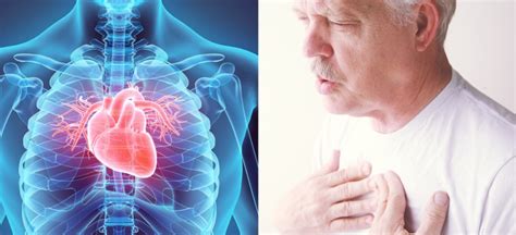 Myocarditis Causes 6 Natural Ways To Help Manage It Dr Axe