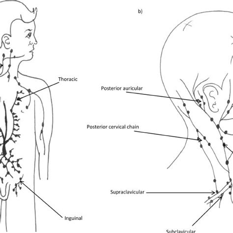 Cervical Lymph Node Drainage And Selected Causes Of Localised Download Table