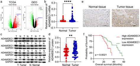 Upregulated Adamdec1 In Nsclc Is Associated With Poor Prognosis A