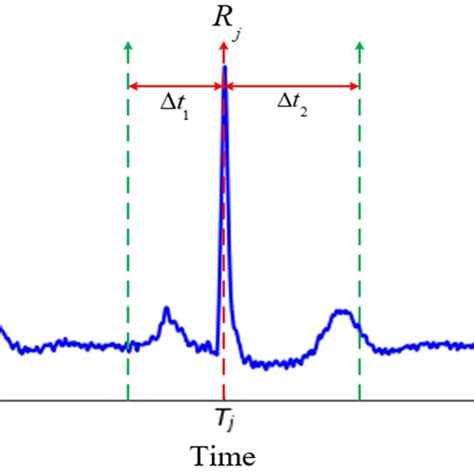 ecg heartbeat segmentation download scientific diagram