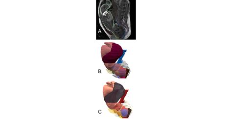 3d Reconstruction And Finite Element Meshing A 2d Image With Mesh