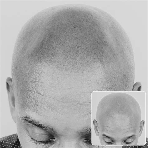 Buzzcut For Men Anna Burns Permanent Cosmetics