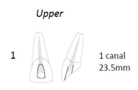 Avg Working Length And Access Outlines Endo Flashcards Quizlet