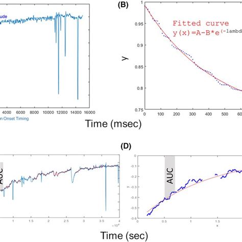 Chromatic Pupillometry Data Analysis Metrics For Rod‐condition Panels Download Scientific