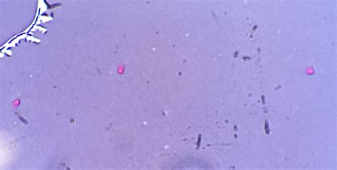 Viability Testing Westlake Ivf