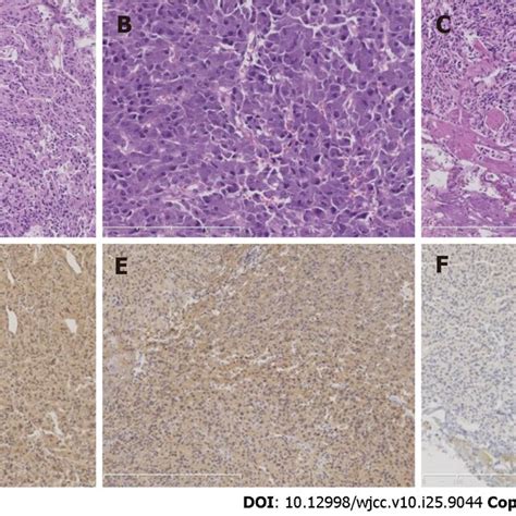 Histological Examination And Immunohistochemical Staining A