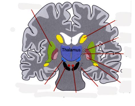 Brain Slice Where Hindbrain Meets Midbrain Quiz