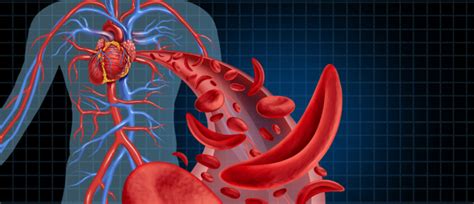 Real World Evidence That Sglt2 Inhibitors Reduce Cardiovascular Risk