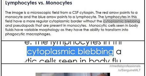 Cell Morphology In Csf Cytoplasmic Cuteness Rmedlabprofessionals