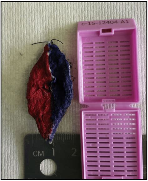 Differential Inking Download Scientific Diagram