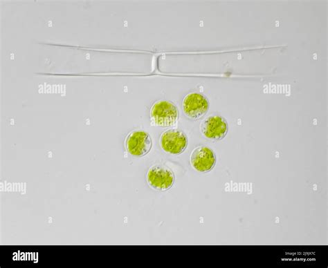 Fresh Water Algae Under The Microscope Horizontal Field Of View About 121 Micrometer Stock