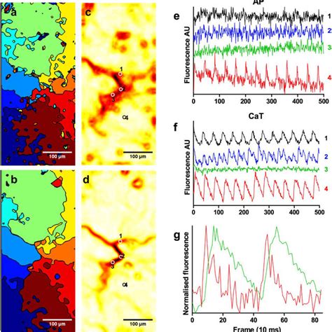 A Activation Map Of Re Entry Circuit In Hl1 6 Dominant Frequency Download Scientific