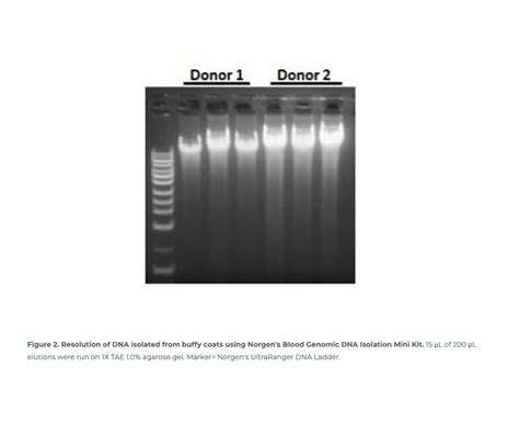 Norgen Biotek™ Blood Dna Isolation 96 Well Kit 2 Plates