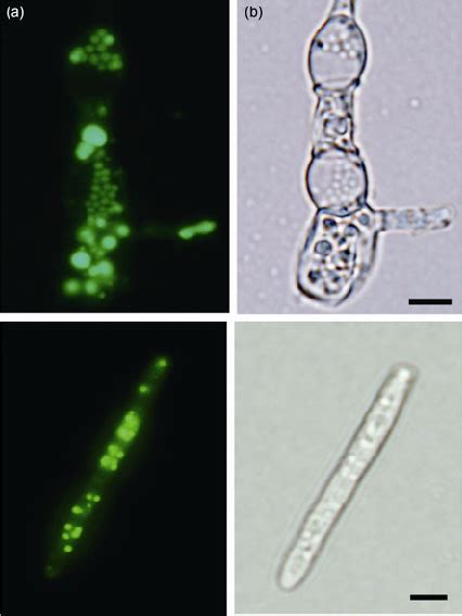Lipid Droplet Staining Of O Sinensis Cells With The Fluorescent Dye