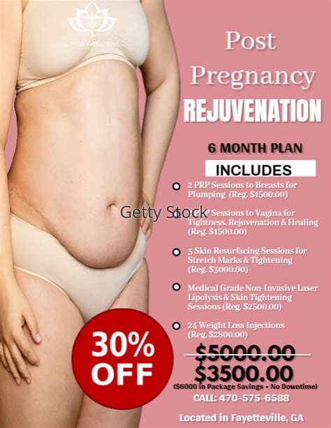 Copy Of Non Surgical Mommy Makeover Flier 1 Postermywall