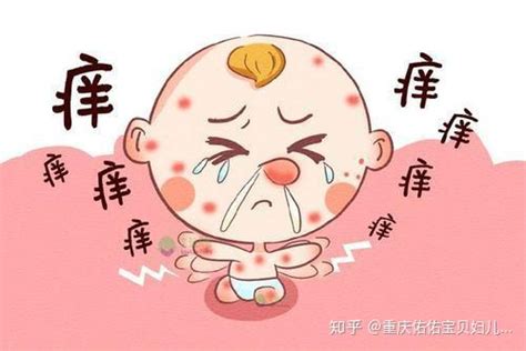 这些容易被忽视的宝宝过敏原因正在危害宝宝 知乎
