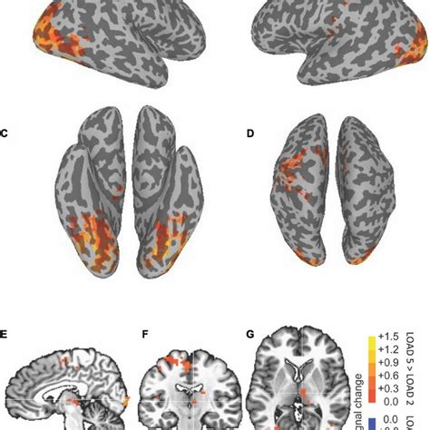 Functional Magnetic Resonance Imaging Fmri Differences Between High Download Scientific