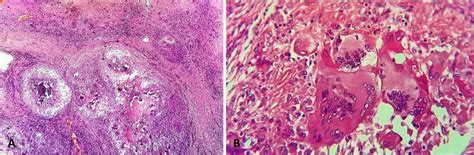 Mucor Histology