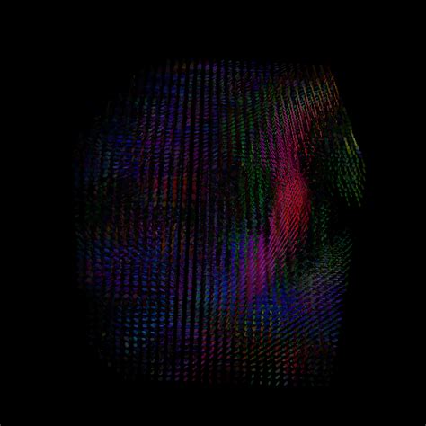 Display Tensor Ellipsoids For Dti Using Tensorslicer Vs Ellipsoid Actor — Fury 0100 Documentation