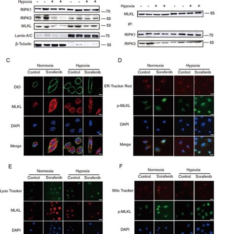 Hypoxia Impeded The Distribution Of Ripk1 Ripk3 Mlkl Complex In Download Scientific Diagram