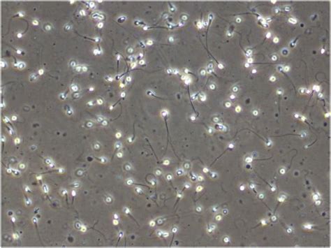 Human Sperm Cell Under Microscope Moving Human Sperm Under Phase