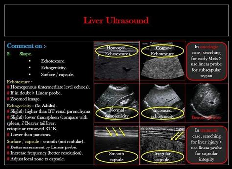 Liver Tips For Us Ultrasound Sonography Diagnostic Medical