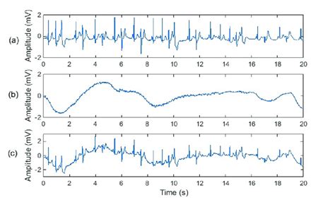 Experimental Signals A Abnormal Ecg From The Mit Bih Database