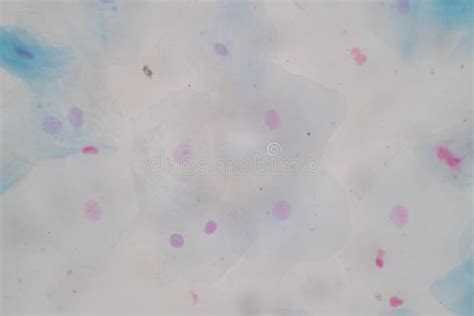 Histologisch Monster Plaveiselcel Epitheelcellen Onder Microscoop