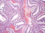 Secretory Phase Endometrium Libre Pathology