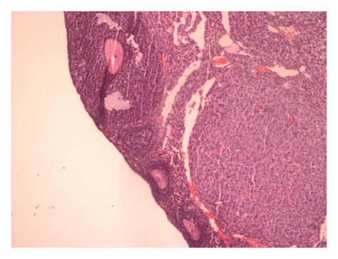Photomicrograph Hande Stained From Histological Ovaries Sections