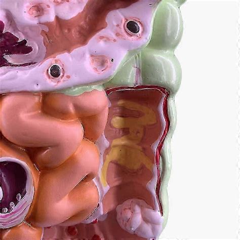 Human Digestive System Model Stomach Anatomy Large Intestine Cecum