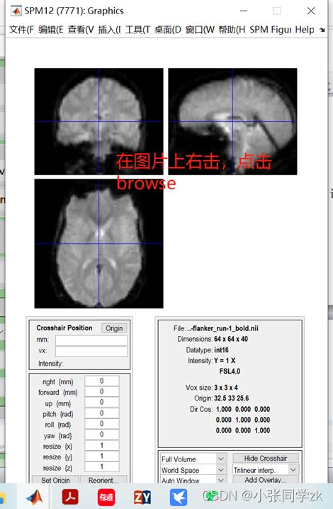 基于spm12对fmri数据的分析（超详细） Csdn博客