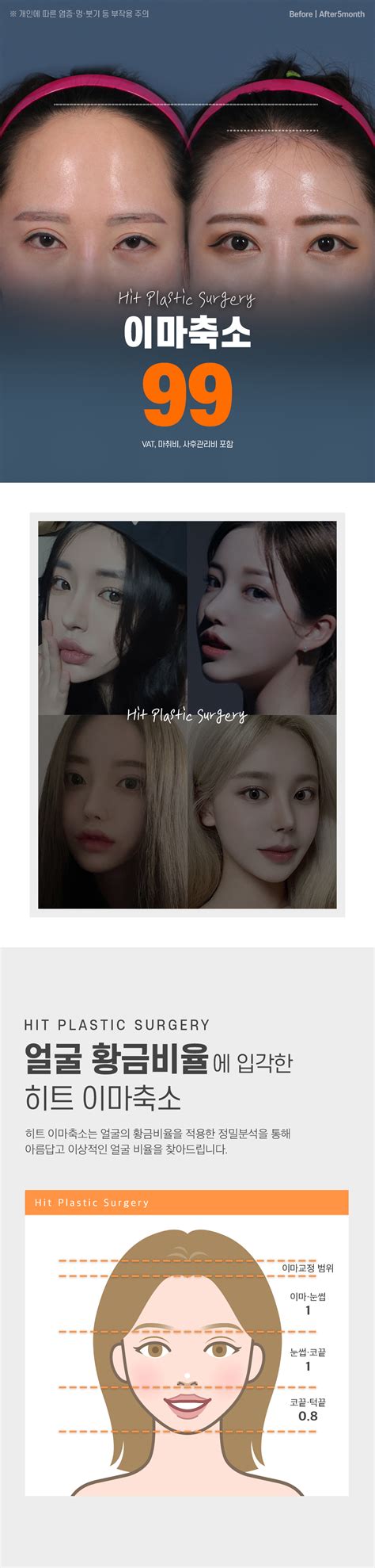 히트이마축소 히트성형외과의원